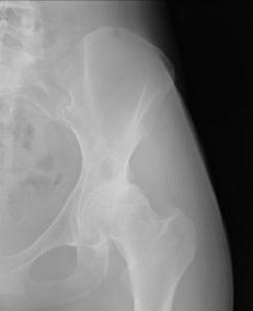 Ann Caviness - LBHR 7/3/07, Dr. Koen DeSmet